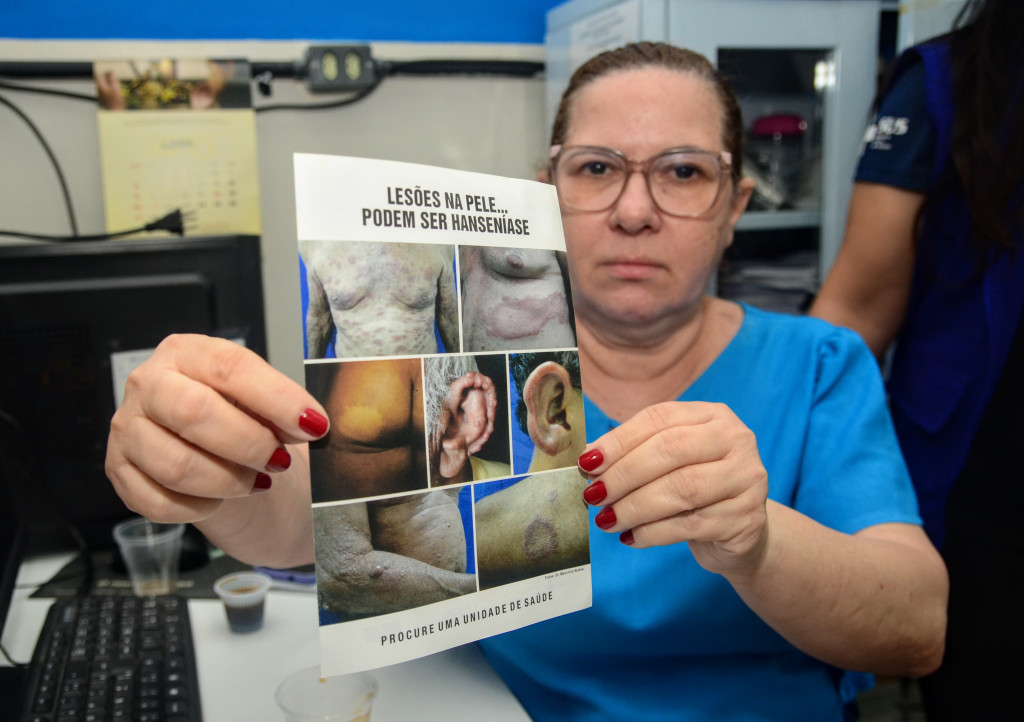 Prefeitura de Mossoró